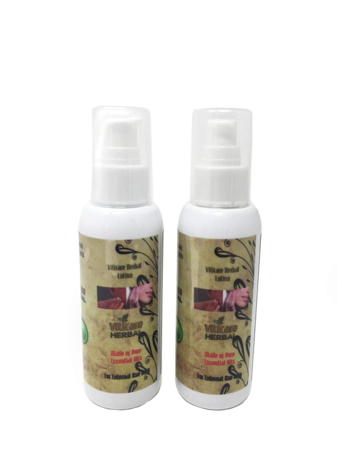 Amazon.com : All Natural and Herbal Lotion for Vitiligo Treatment ...