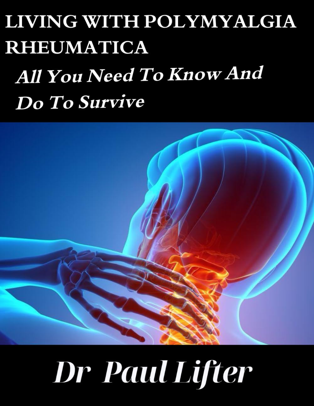 Living with Polymyalgia Rheumatica: All you need to know and do to ...
