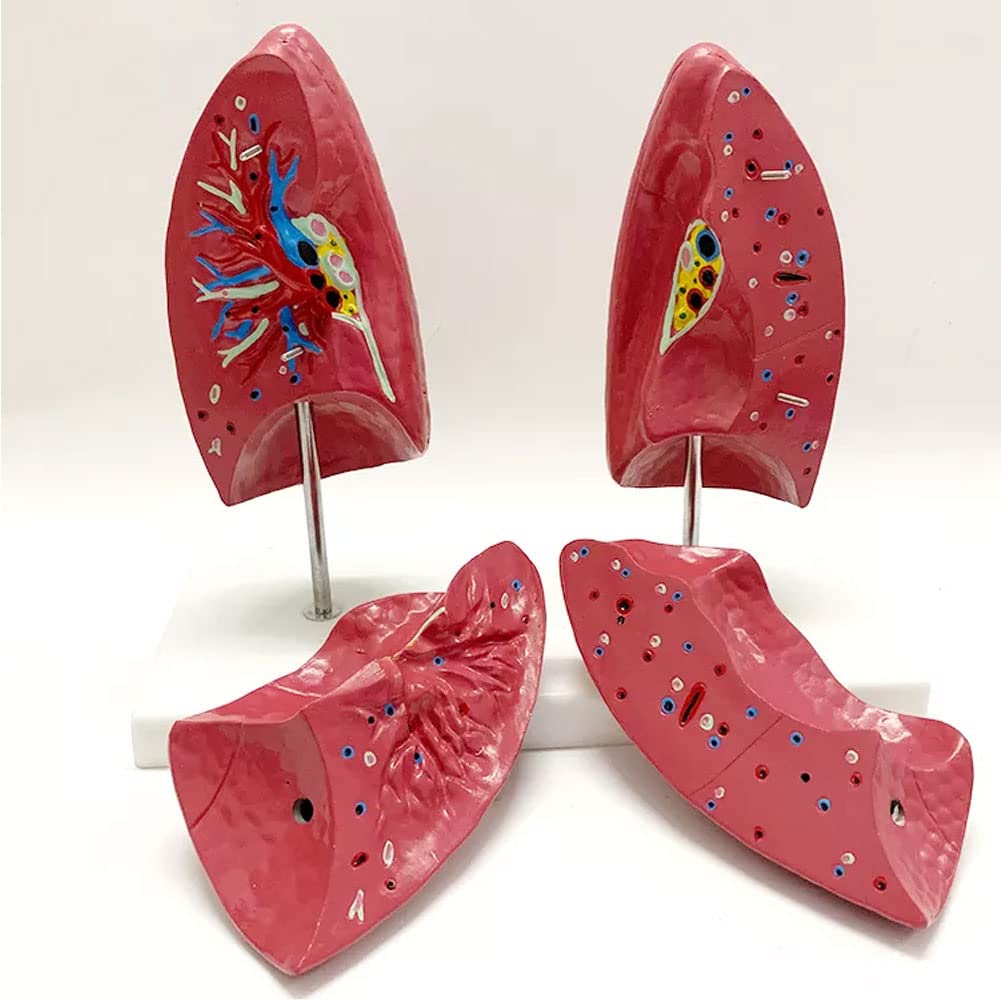 Buy y Lung Anatomy Model - Life Size Human Respiratory System ...
