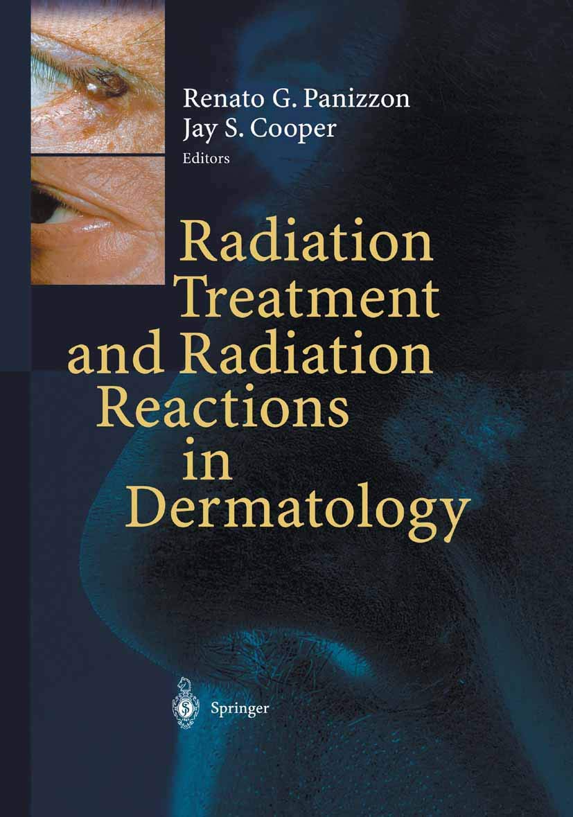 Radiation Treatment and Radiation Reactions in Dermatology ...