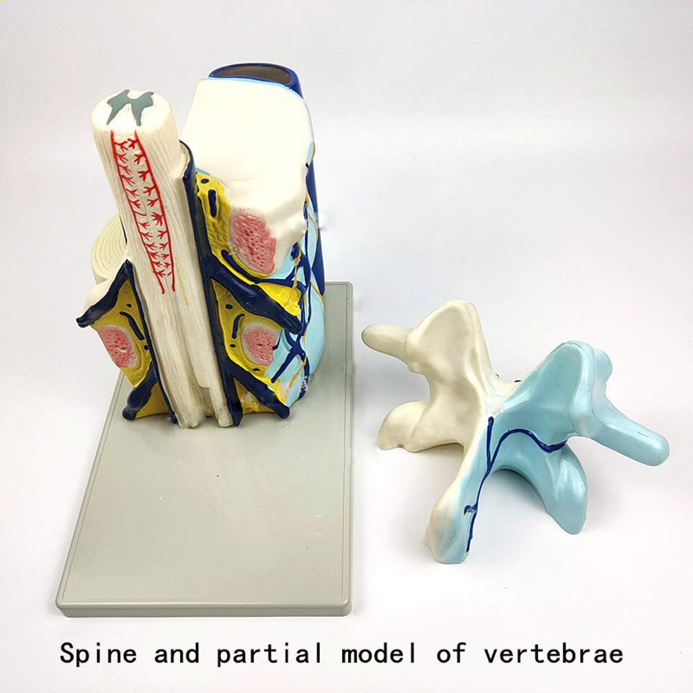 Buy AMITD Spine and Vertebral Models - Model Spinal Nerves and Spinal ...