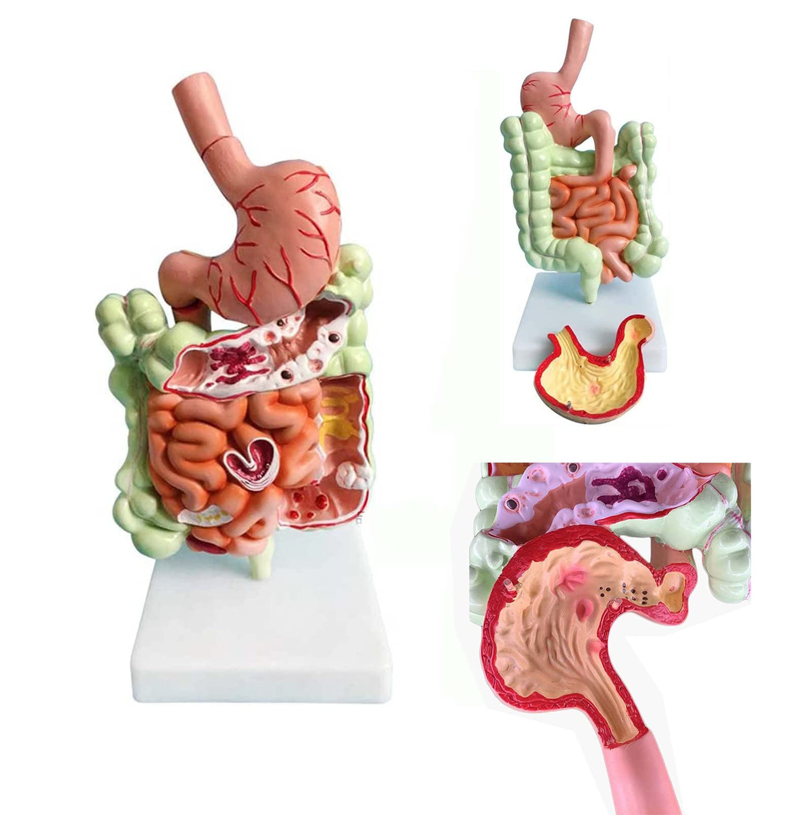 Colon Structure