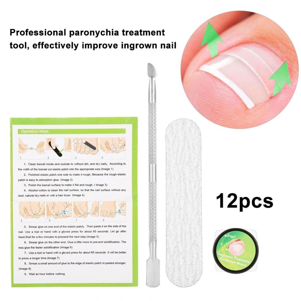 Professional Nail Correction Sticker,Pedicure Paronychia Recover ...