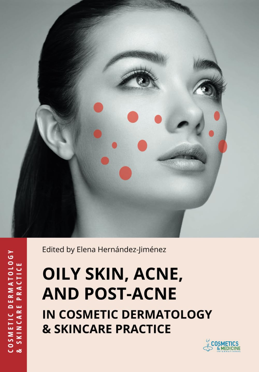 Oily Skin, Acne, and Post-Acne in Cosmetic Dermatology & Skincare ...
