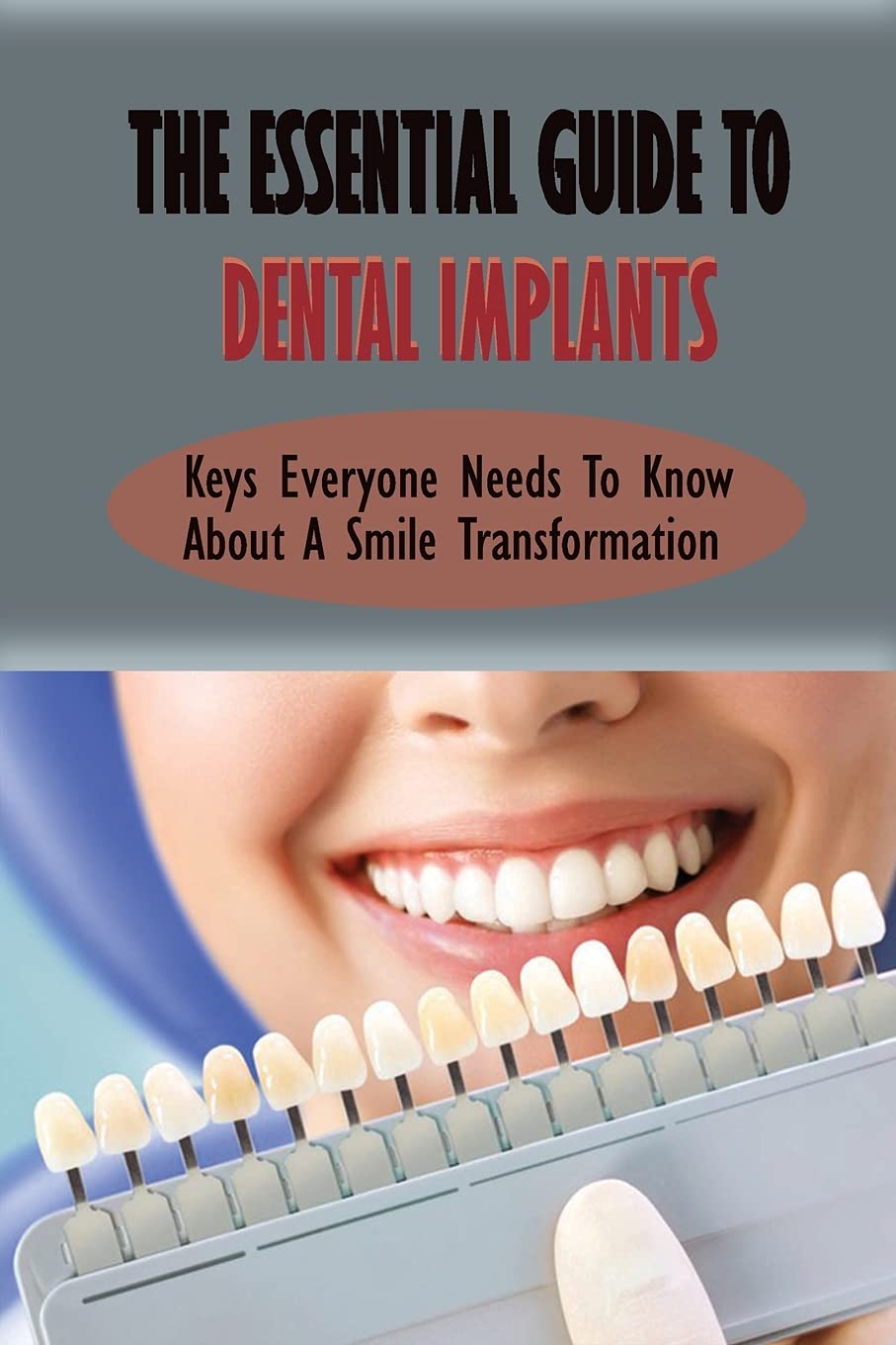 Buy The Essential Guide To Dental Ims: Keys Everyone Needs To Know ...