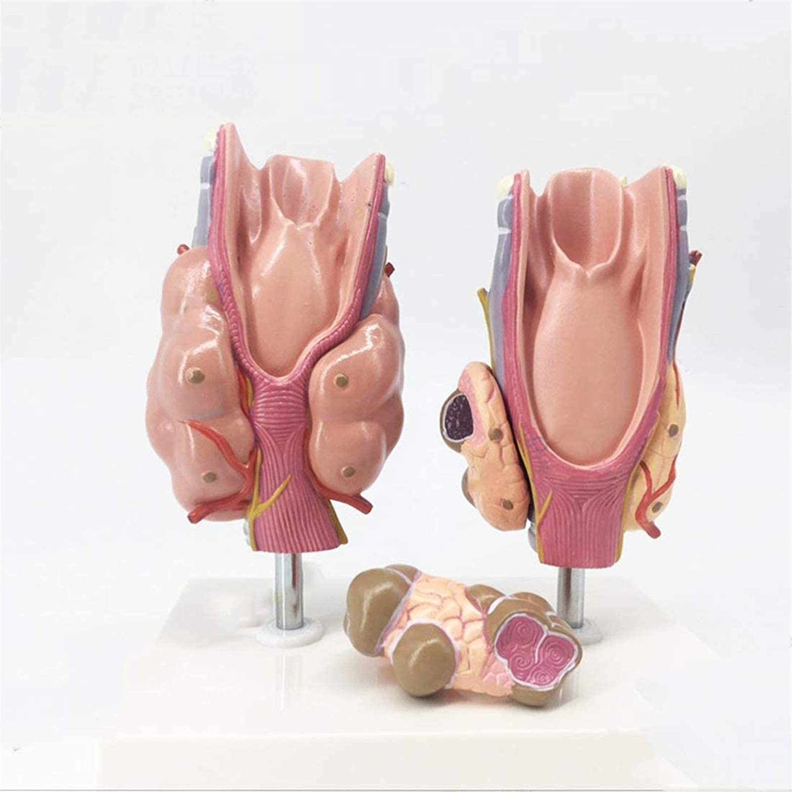 Anatomy Model Educational Model Human Thyroid Gland Pathology Model ...