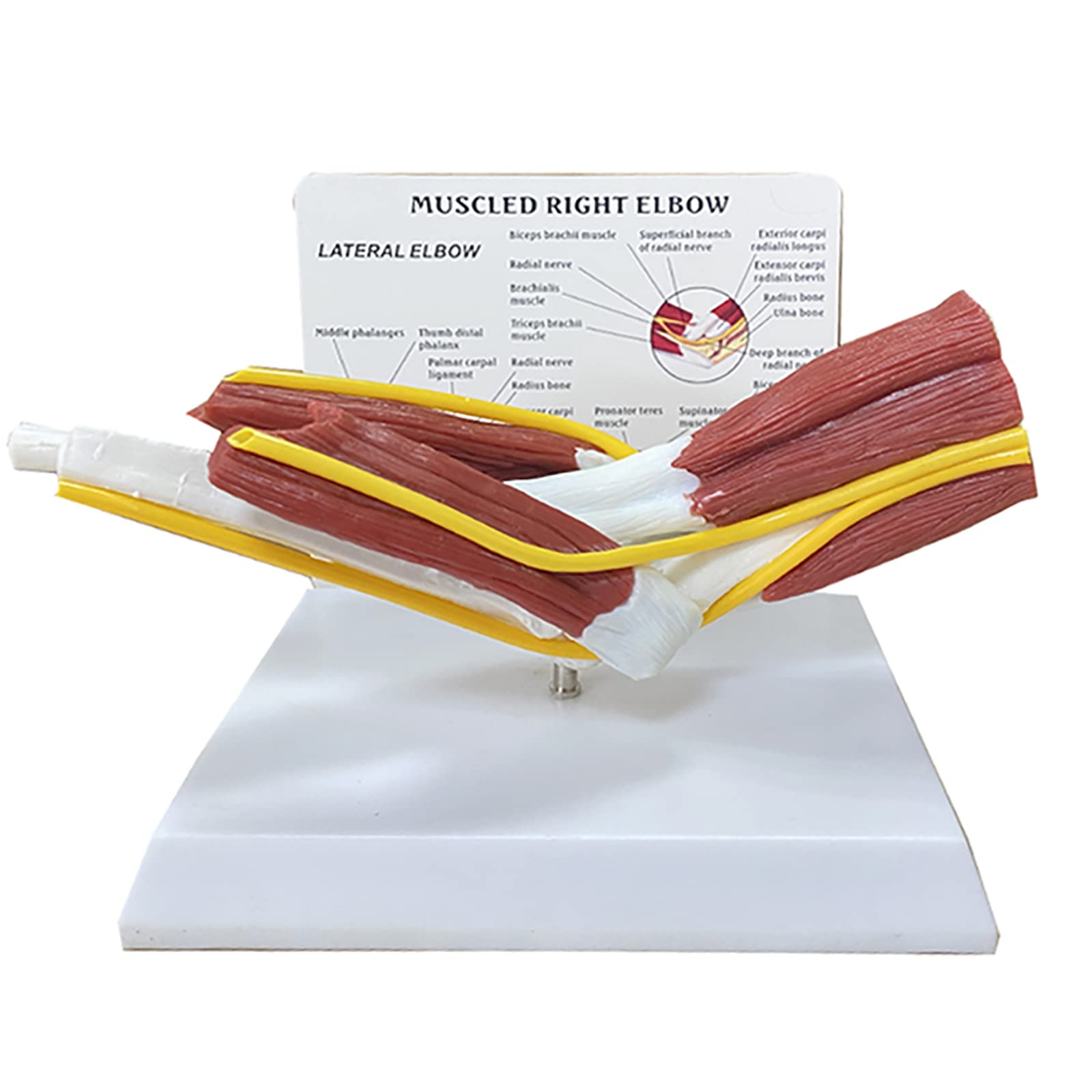 Buy ERICAT Human Elbow Joint Anatomical Model, Right Elbow Joint ...