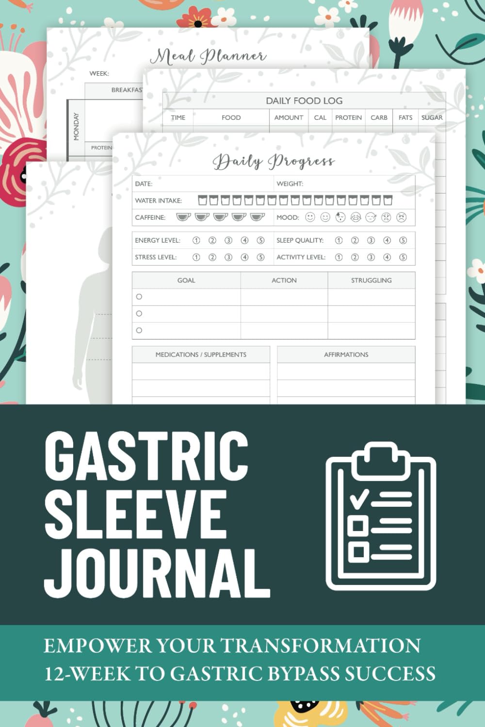 Gastric Sleeve Journal: 12-Week Bariatric Planner For Gastric Bypass ...