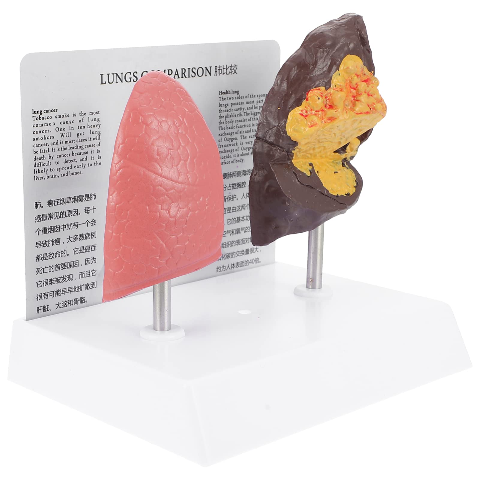Human Lungs Smoker