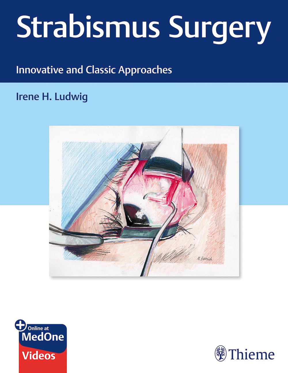 Strabismus Surgery: Innovative and Classic Approaches: 9781626235267 ...