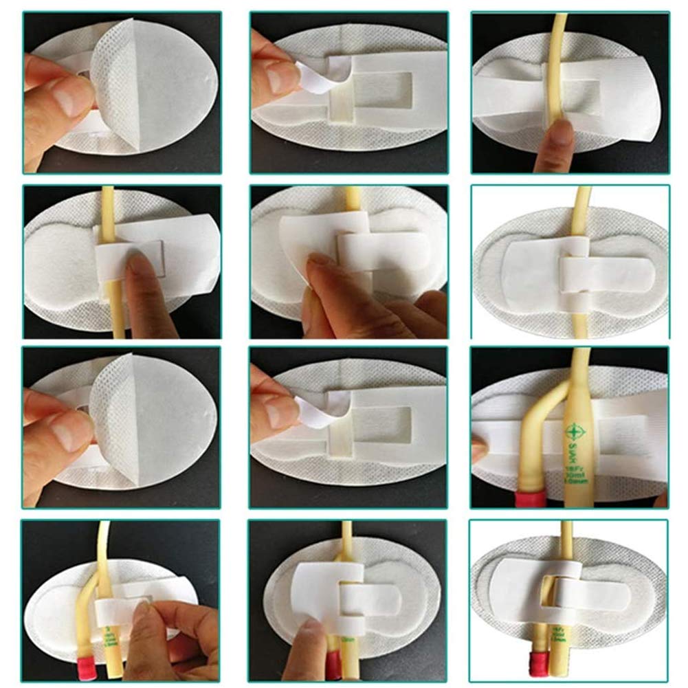 WSN Catheter Holder Bard Statlock, Urinary Tube Fixing Sticker ...