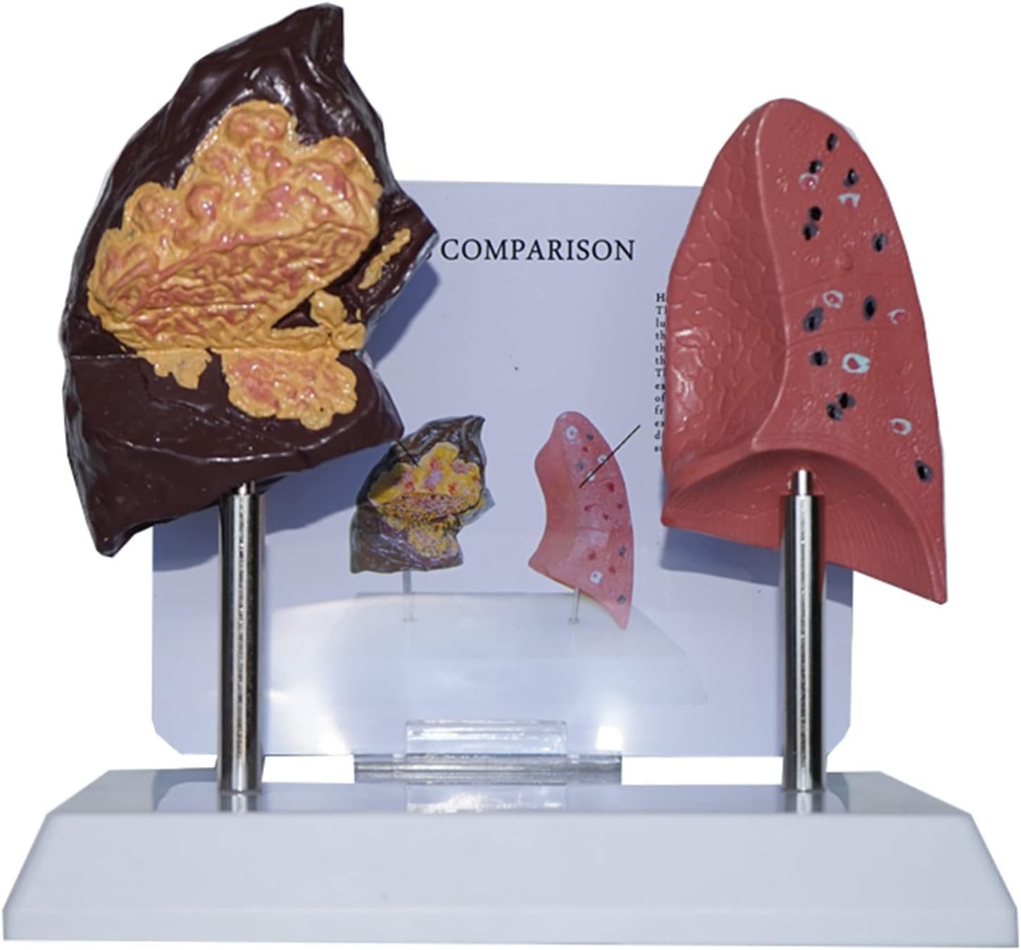 Amazon.com: DKULMN Lung Anatomy Model,Smokers Lung Model + Healthy Lung ...