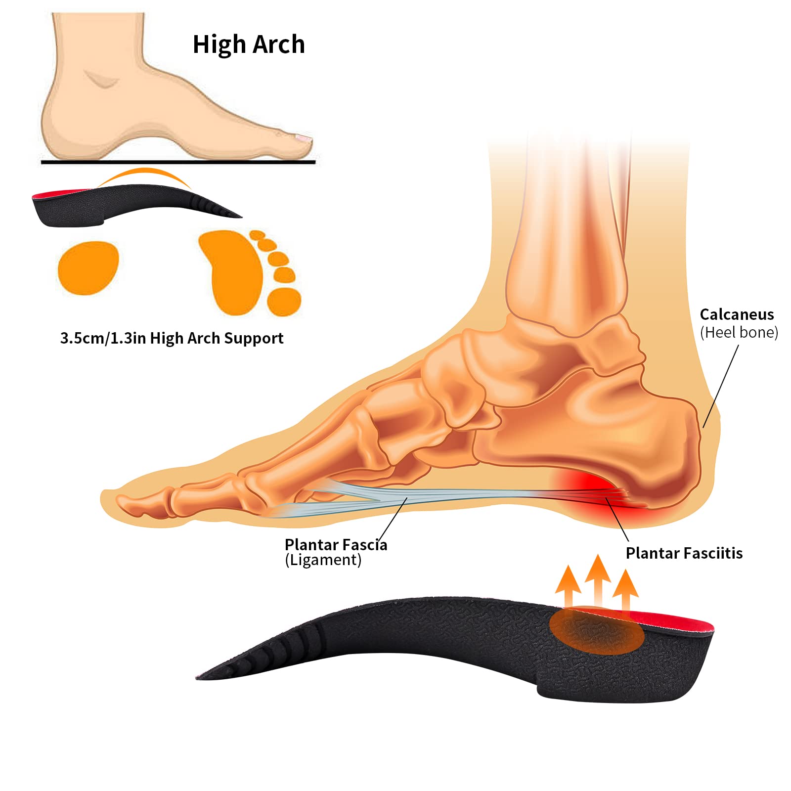Snapklik.com : FeetTouch 3/4 High Arch Rigid Orthotics For Plantar ...