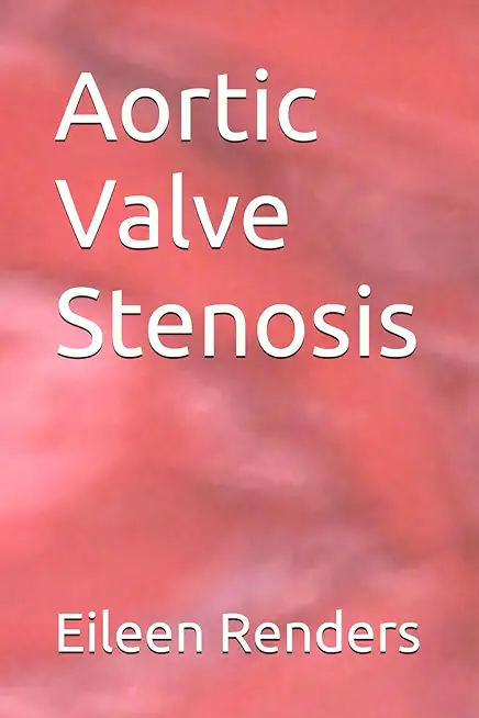 Understanding Nonrheumatic Aortic Valve Stenosis: Causes, Symptoms, And Treatment | MedShun