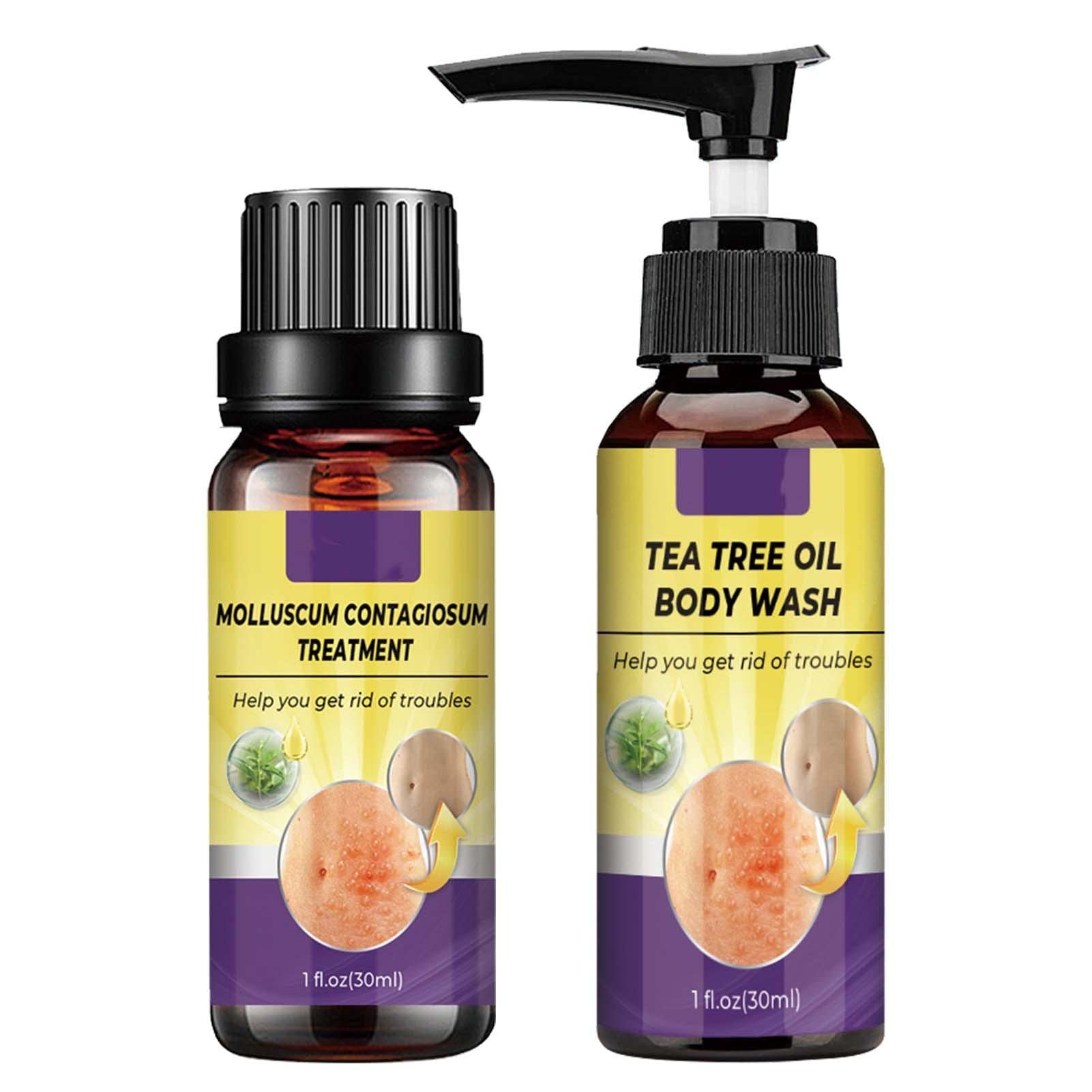 Buy Molluscum Oil - Molluscum Contagiosum Kit For Molluscum Contagiosum ...