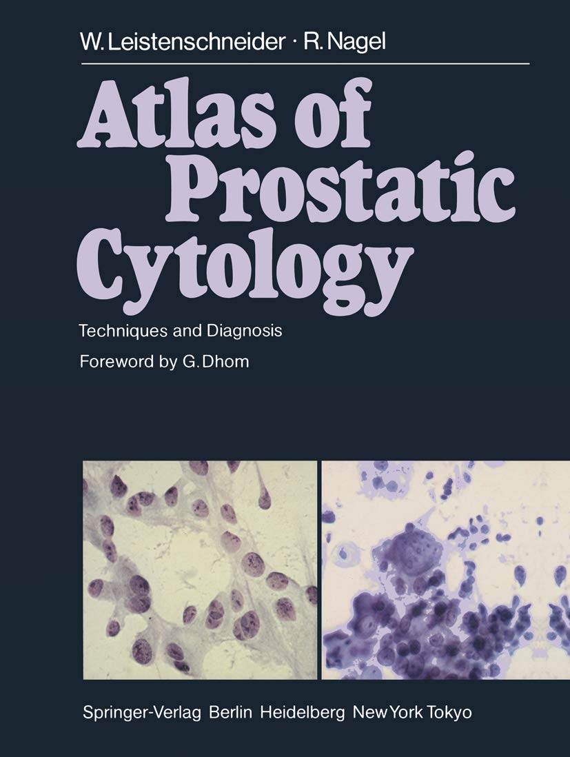 Atlas of Prostatic Cytology: Techniques and Diagnosis: 9783642701122 ...