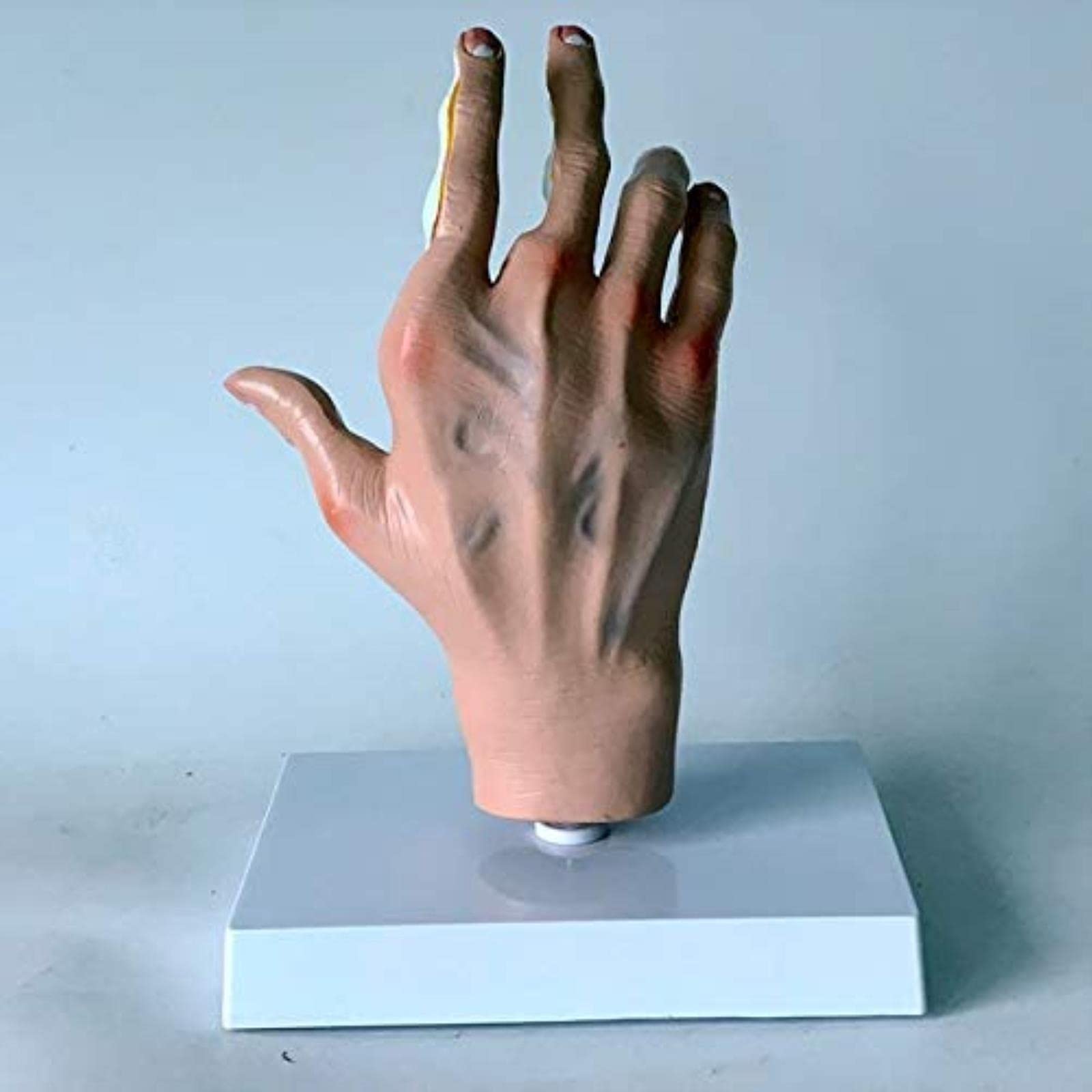Palm Anatomy Models Hand Anatomy Model Anatomy Diseased Palm Tendon ...