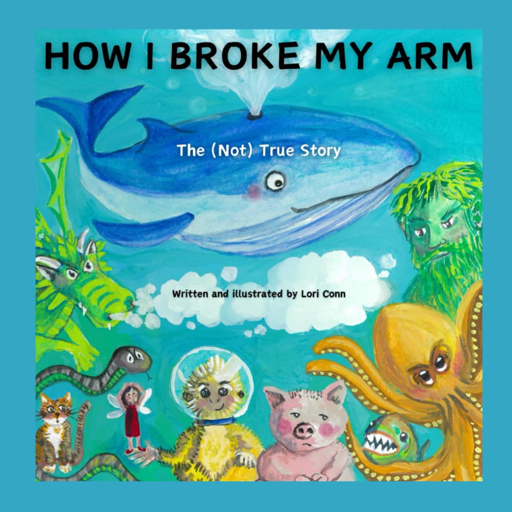 How I Broke My Arm: The (Not) True Story : Conn, Lori: Amazon.co.uk: Books