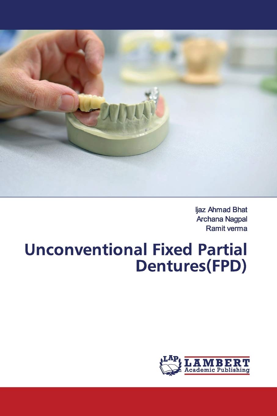 Buy Unconventional Fixed Partial Dentures(FPD) Book Online at Low ...