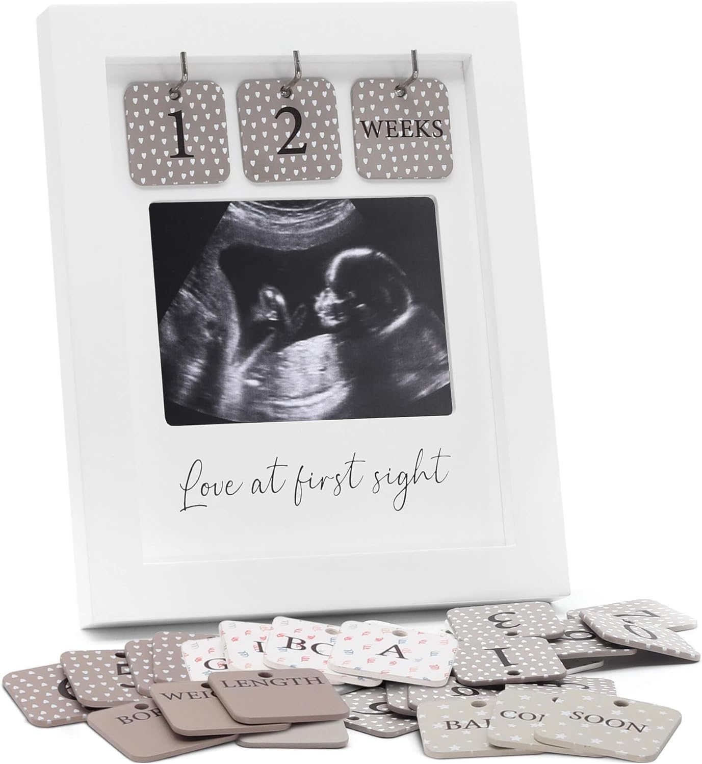 Amazon.com: Ultrasound Picture Frames W/ Free Digital Pregnancy Journal ...