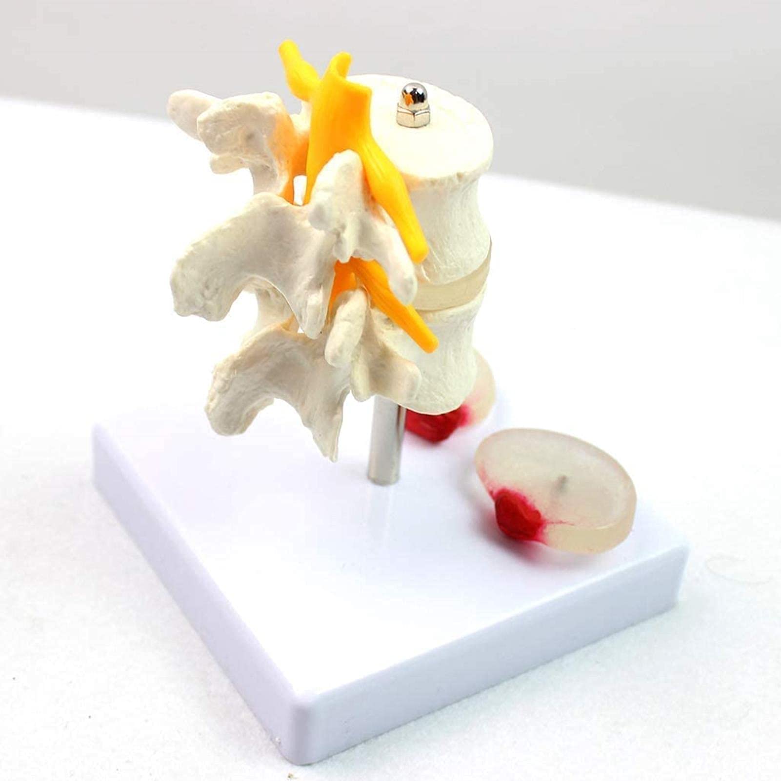 Buy SENWEI Educational Model Anatomical Skeletal Model of Diseased ...
