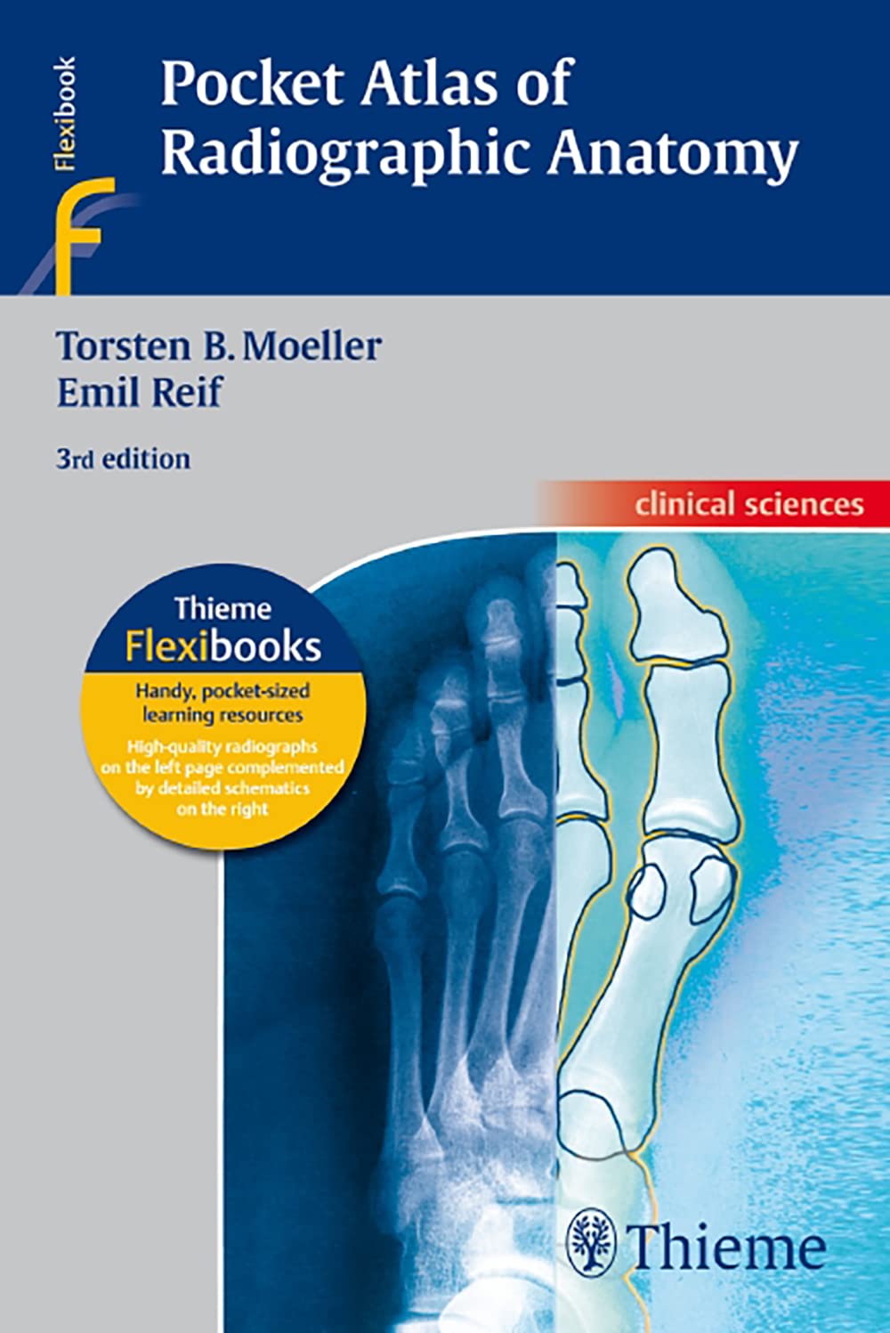 Pocket Atlas of Radiographic Anatomy (Flexibooks) : Möller, Torsten ...