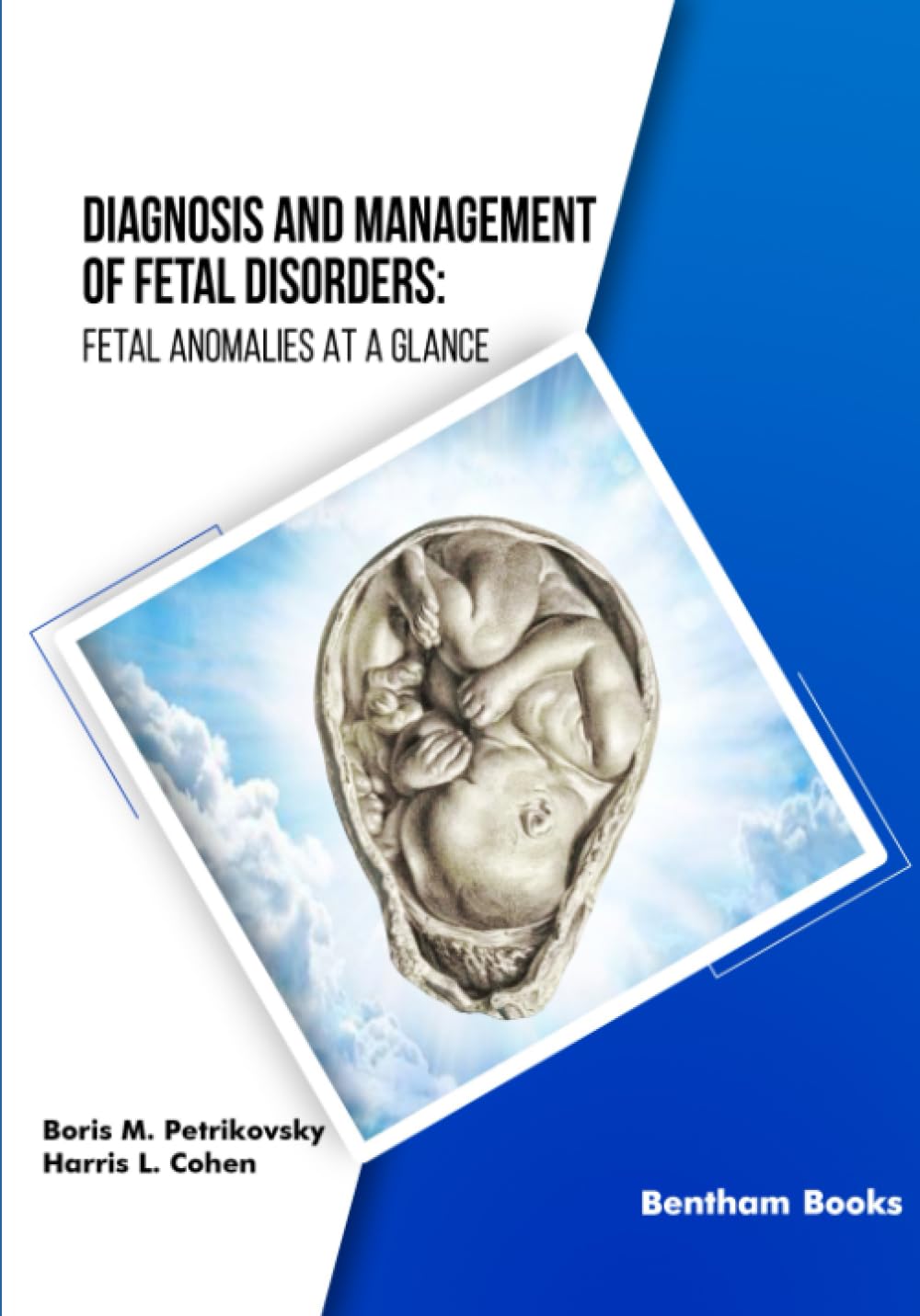 Diagnosis and Management of Fetal Disorders: 9789815079654: Medicine ...