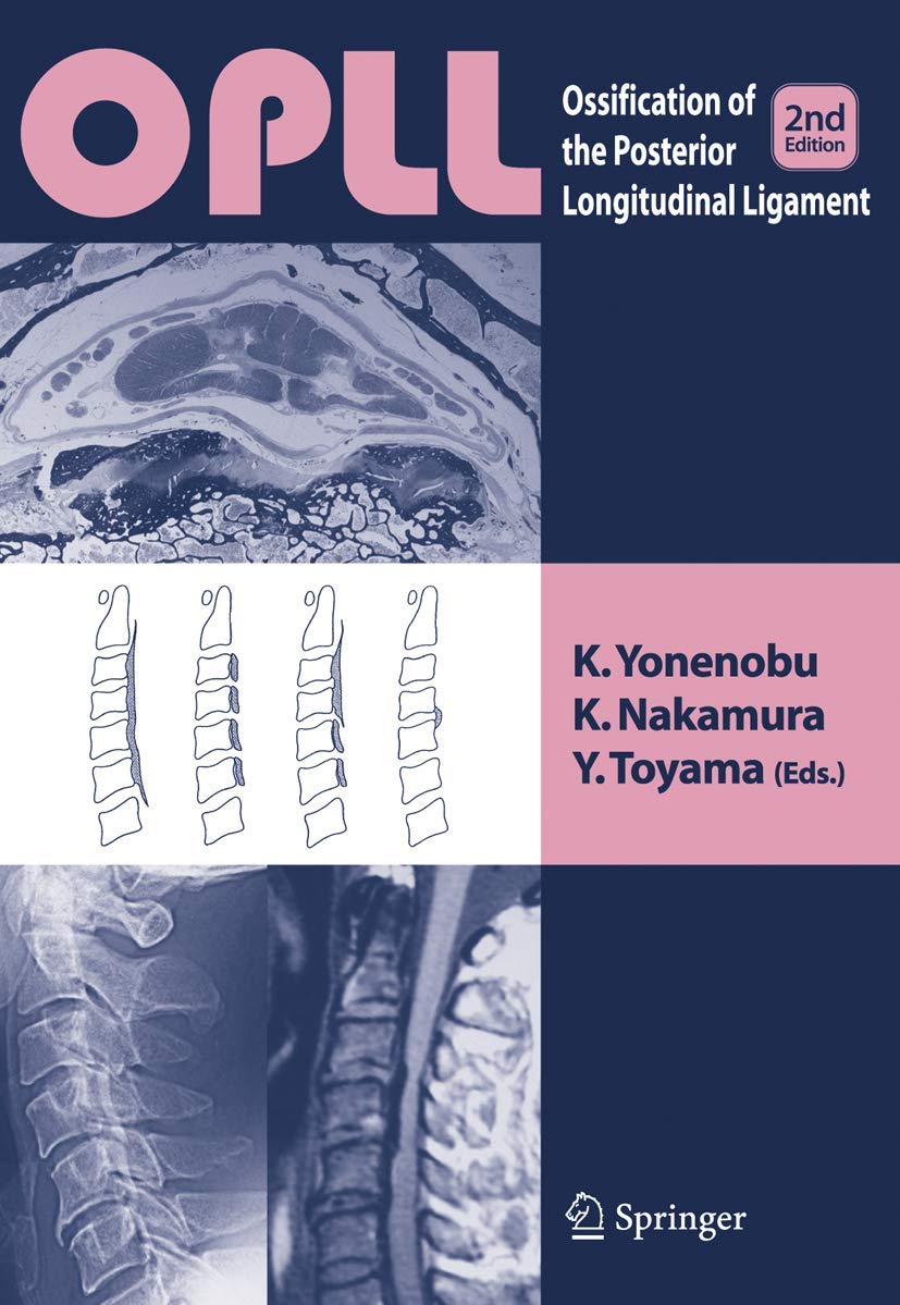 Opll: Ossification of the Posterior Longitudinal Ligament: Yonenobu, K ...