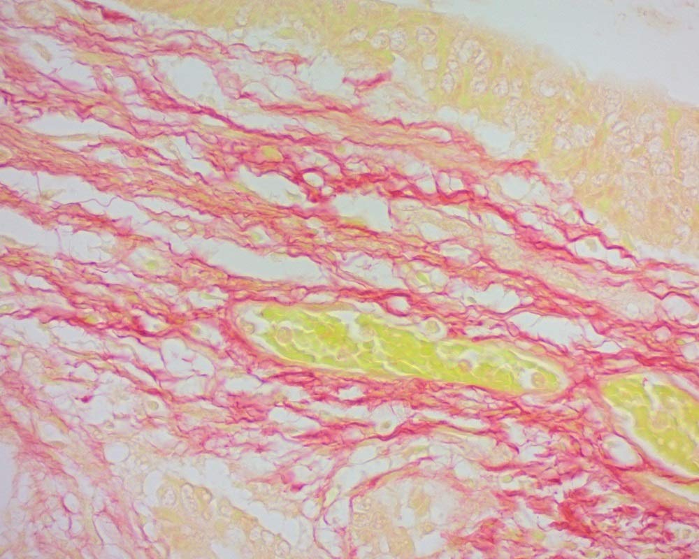 Picrosirius Red Solution 500ml | Desertcart INDIA