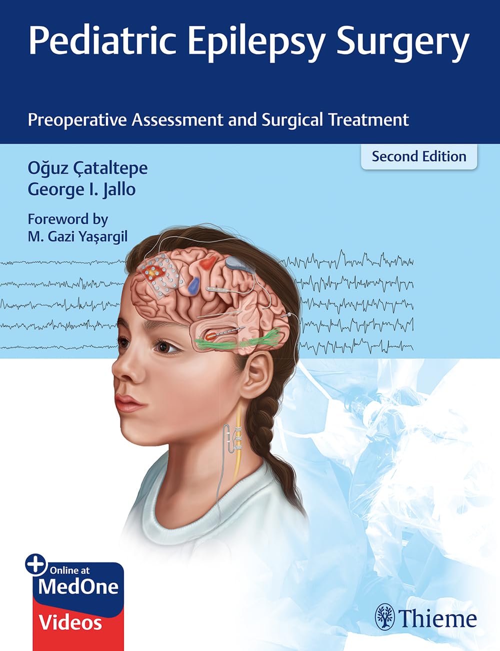 Snapklik.com : Pediatric Epilepsy Surgery: Preoperative Assessment And ...