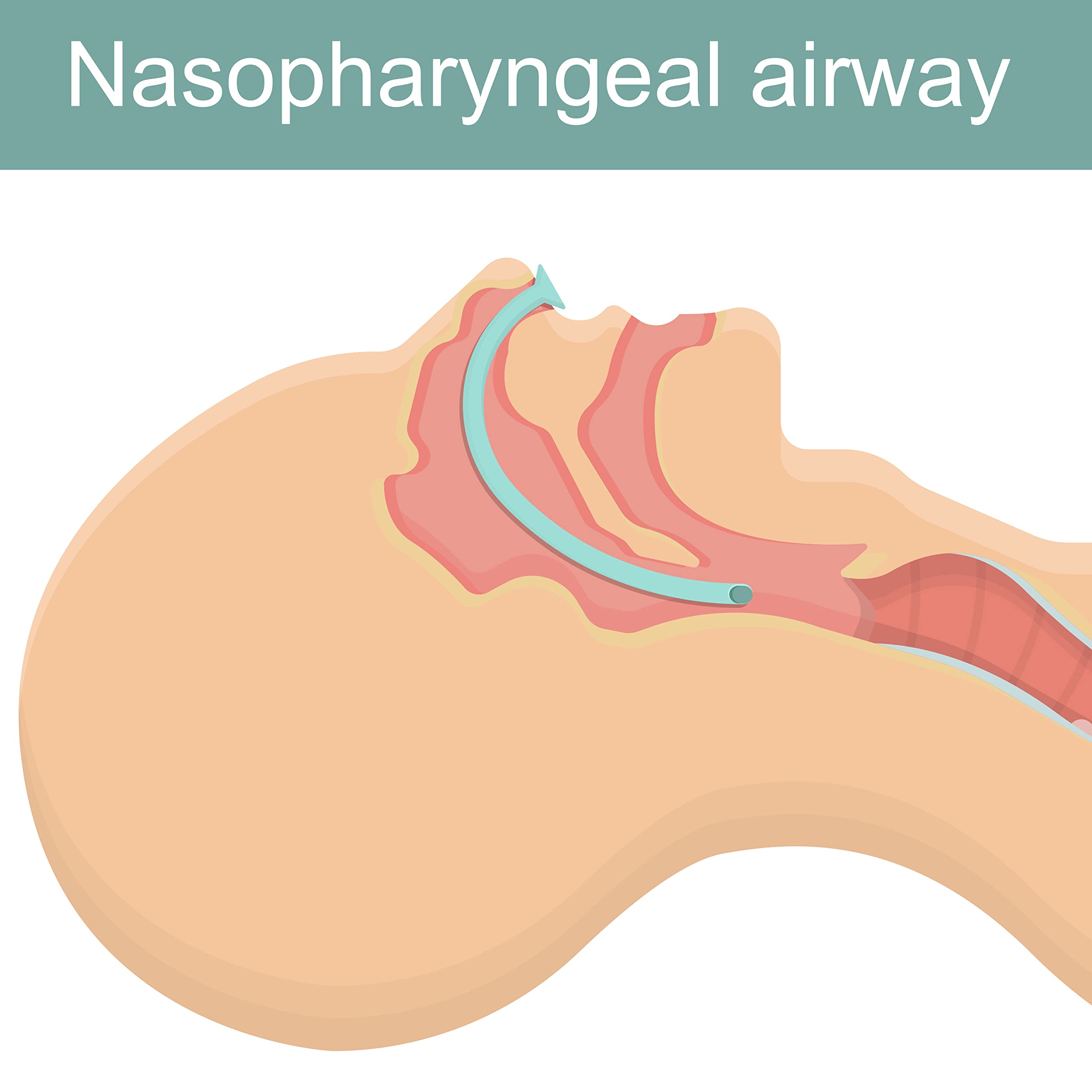 Oropharyngeal Airway Diagram