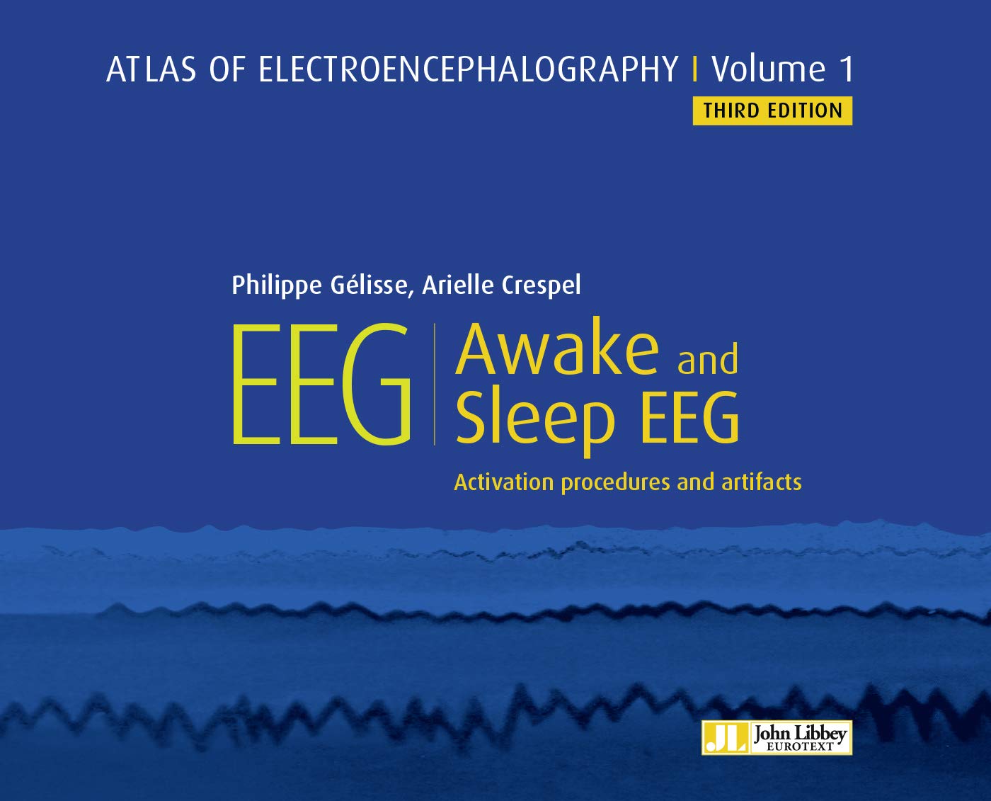 Atlas Of Electroencephalography Awake And Sleep Eeg Activation ...