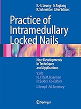 Understanding Tibial Nails: Essential Guide To Intramedullary Fixation ...