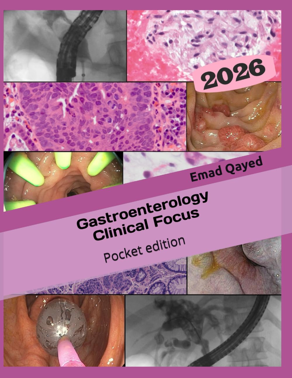Gastroenterology Clinical Focus - Pocket edition: High yield GI and ...