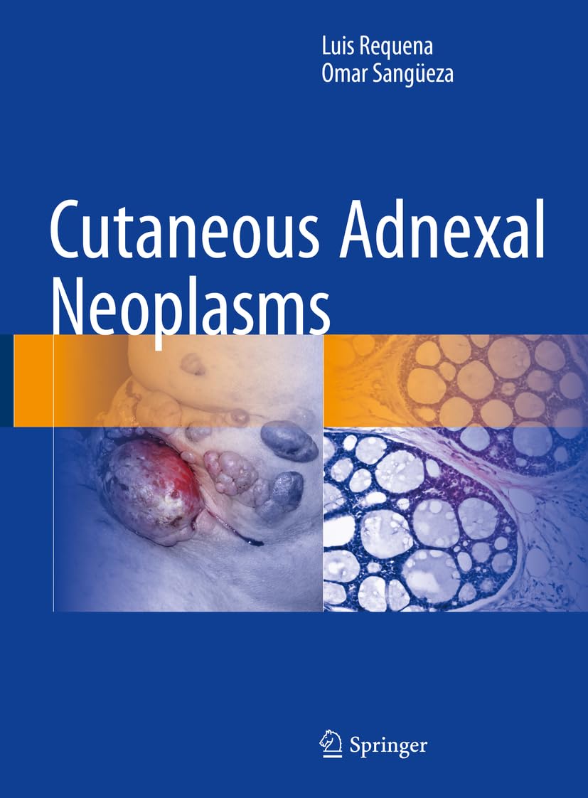Amazon | Cutaneous Adnexal Neoplasms | Requena, Luis, Sangueeza, Omar ...