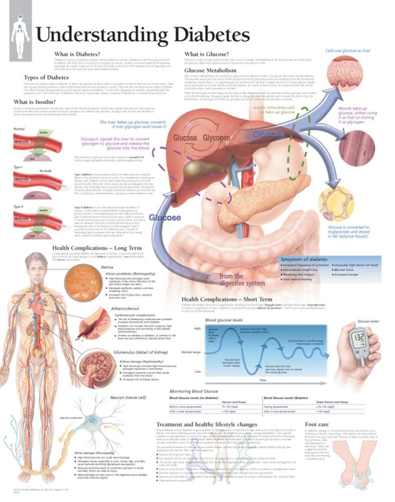 Understanding Diabetes Paper Poster: Wall Chart | Amazon.com.br