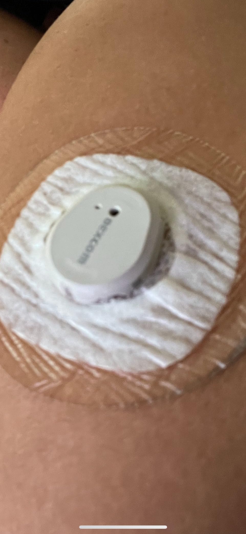 $4/mo - Finance Dexcom G6 Adhesive Patches, Pack of 20, Lexcam ...