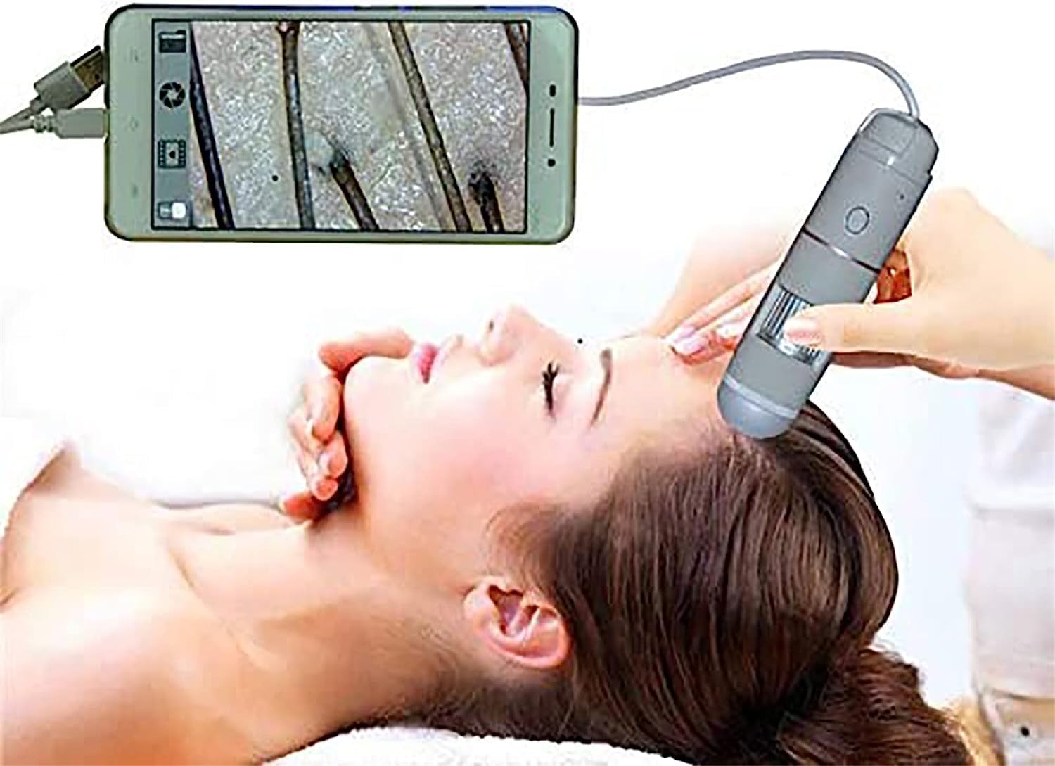 Amazon.com: USB Skin Hair Scalp Detector, Scalp Follicle Detector ...