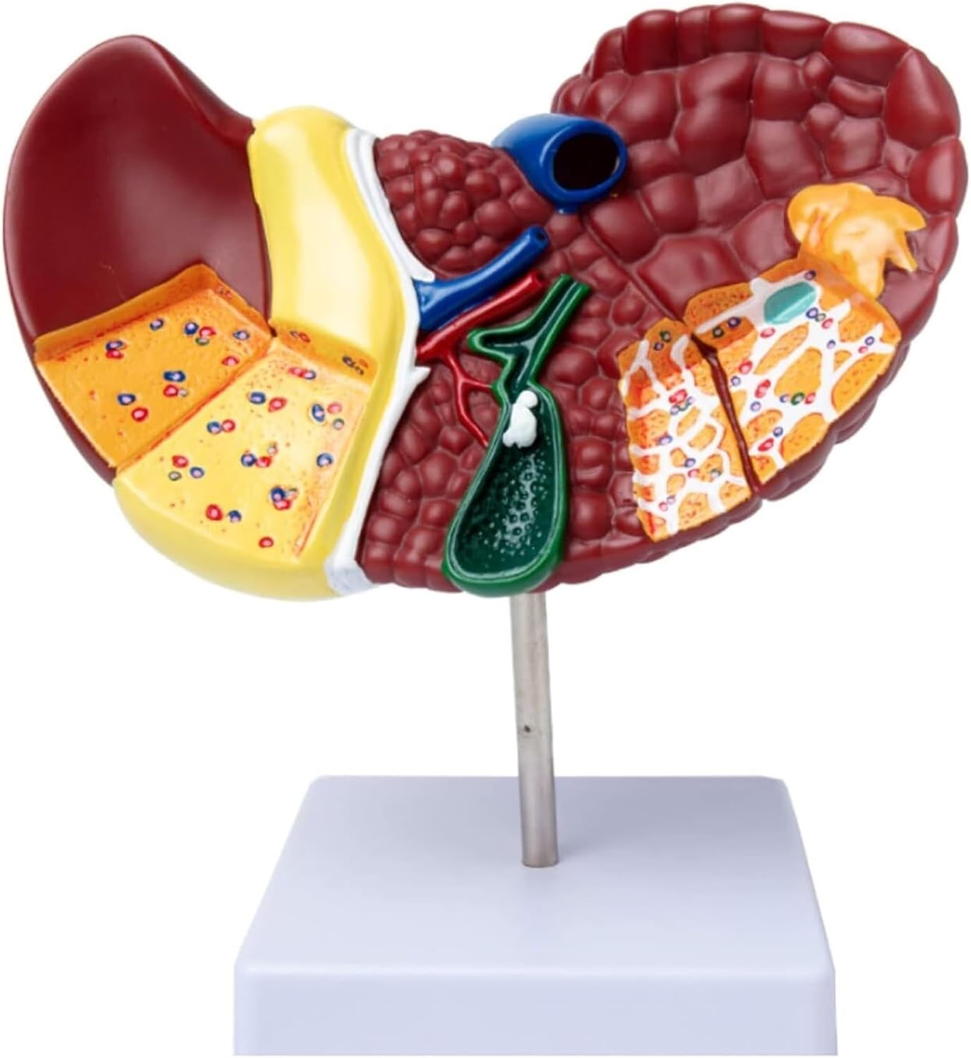 Amazon.com: NICRX Human Torso Model Human Liver Anatomical Model ...