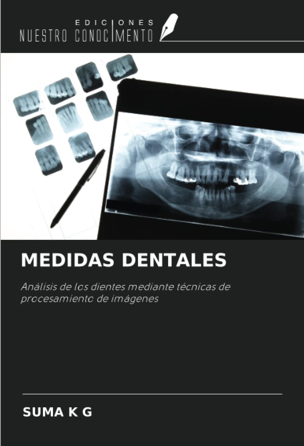 MEDIDAS DENTALES: Análisis de los dientes mediante técnicas de ...