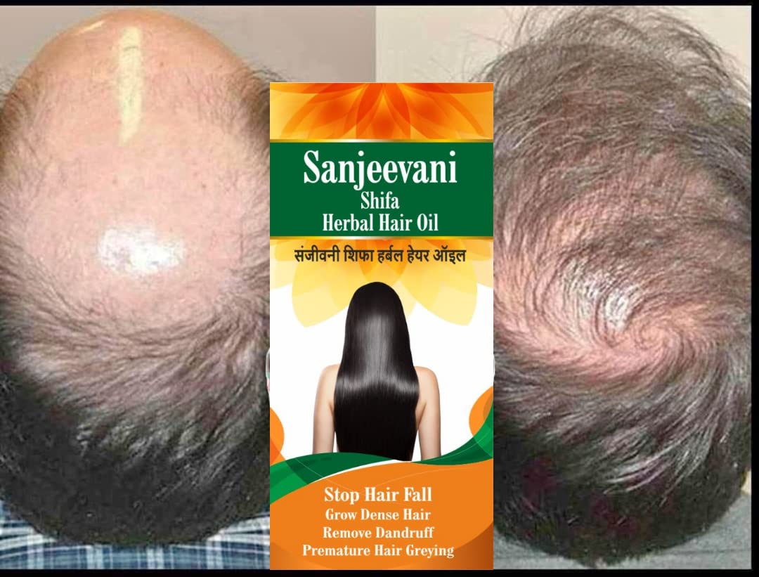 Buy Sanjeevani Shifa a hair oil for remove Dandruff, Hair fall and grow ...