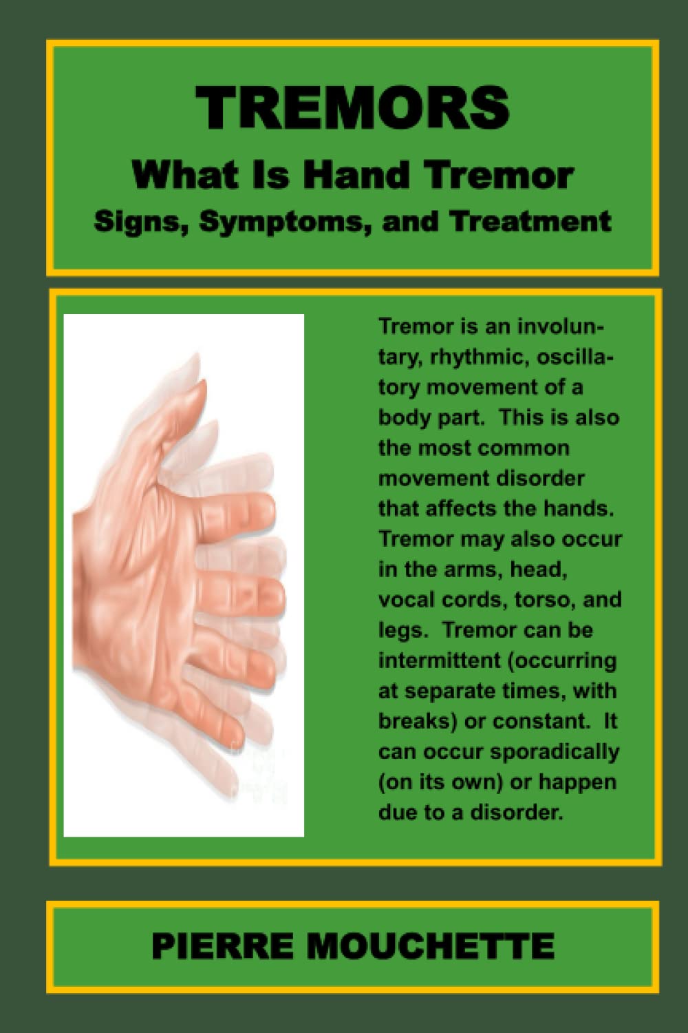 Buy HAND TREMORS - What Is Hand Tremor, Signs, Symptom Paperback ...