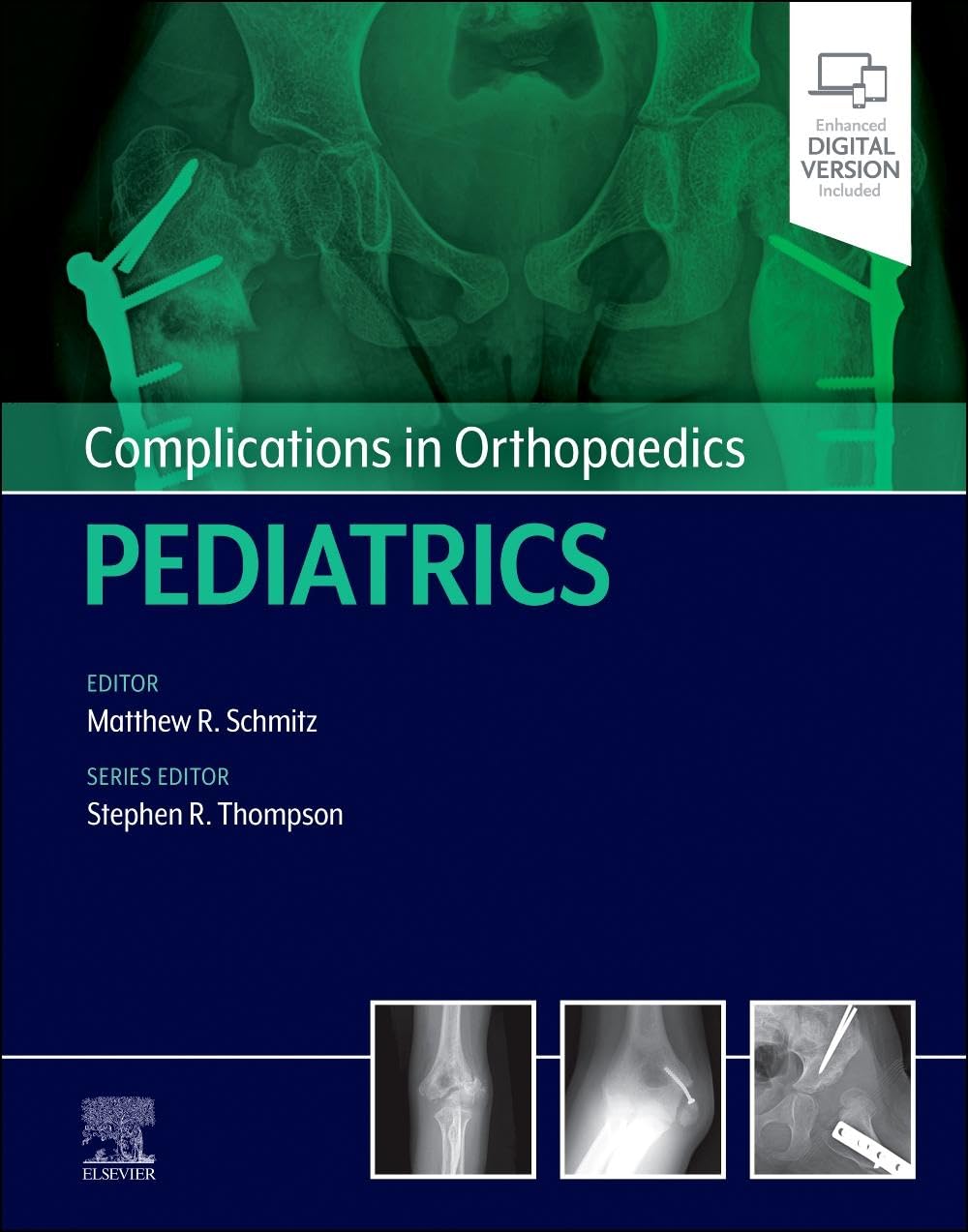 Amazon | Complications in Orthopaedics: Pediatrics | Schmitz, Matthew ...