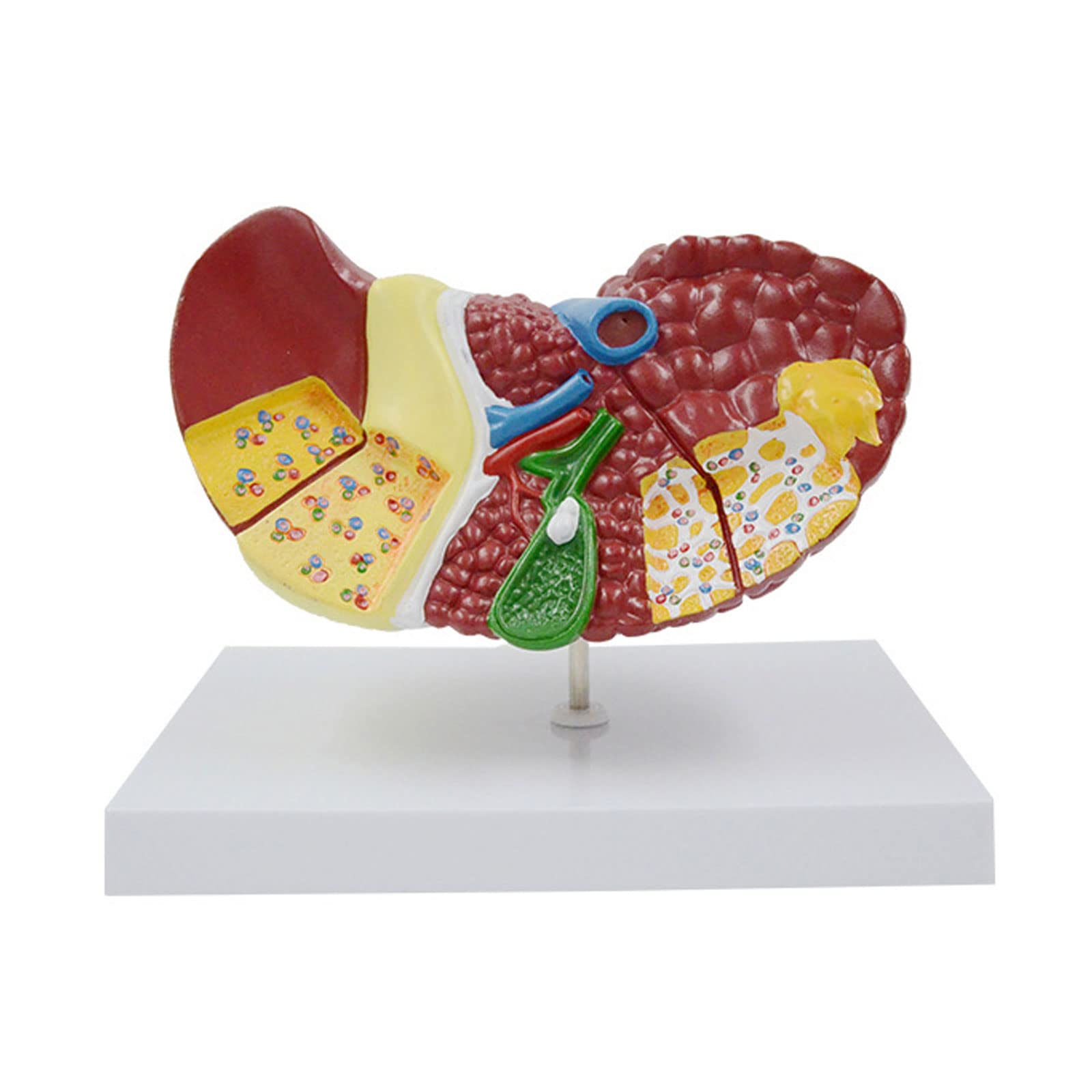 Buy Human Liver Model Liver Disease Liver Tissue Lesions Humanbody ...