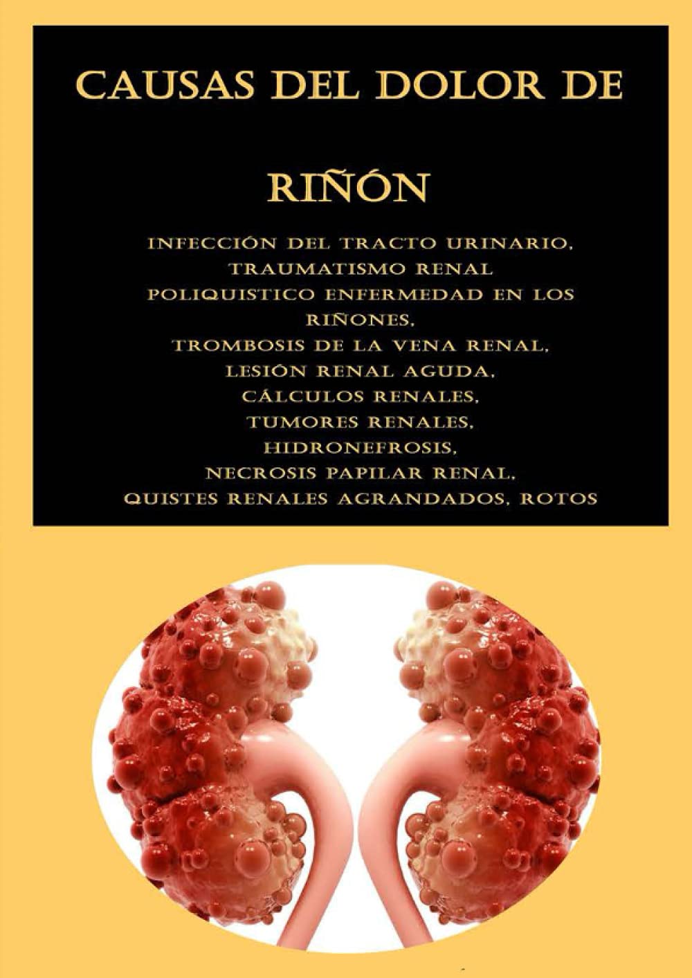 Causas Del Dolor De Rinon Infeccion Del Tracto Urinario Traumatismo ...