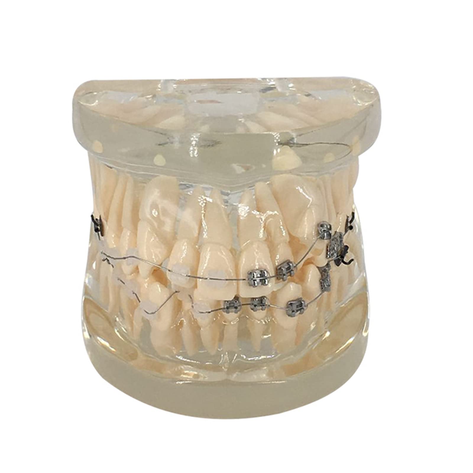 Transparent Dental Orthodontic Brackets Model Dental Teeth Orthodontic ...