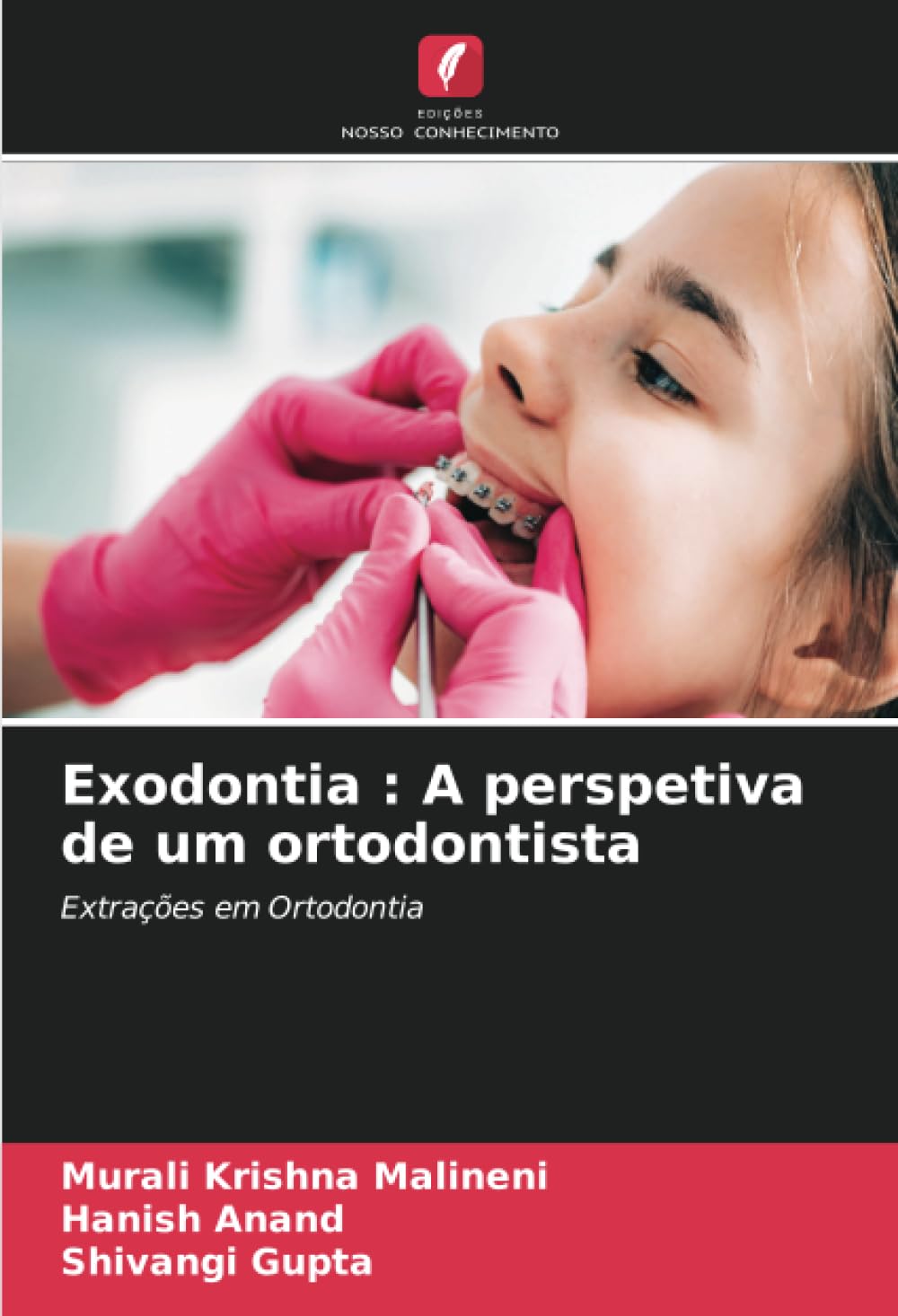Buy Exodontia: A perspetiva de um ortodontista Book Online at Low ...