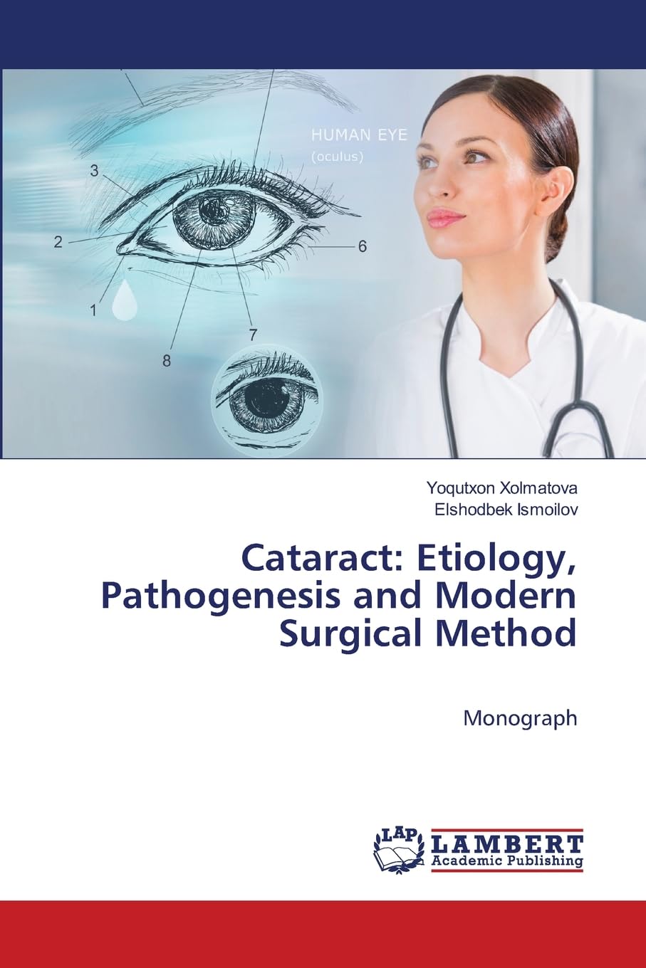 Buy Cataract: Etiology, Pathogenesis and Modern Surgical Method Book ...