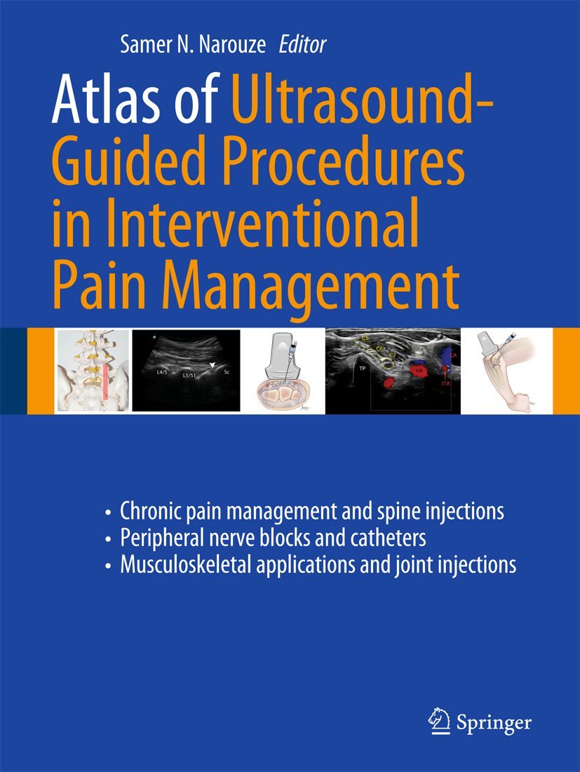 Buy ATLAS OF ULTRASOUND GUIDED PROCEDURES IN INTERVENTIONAL PAIN ...