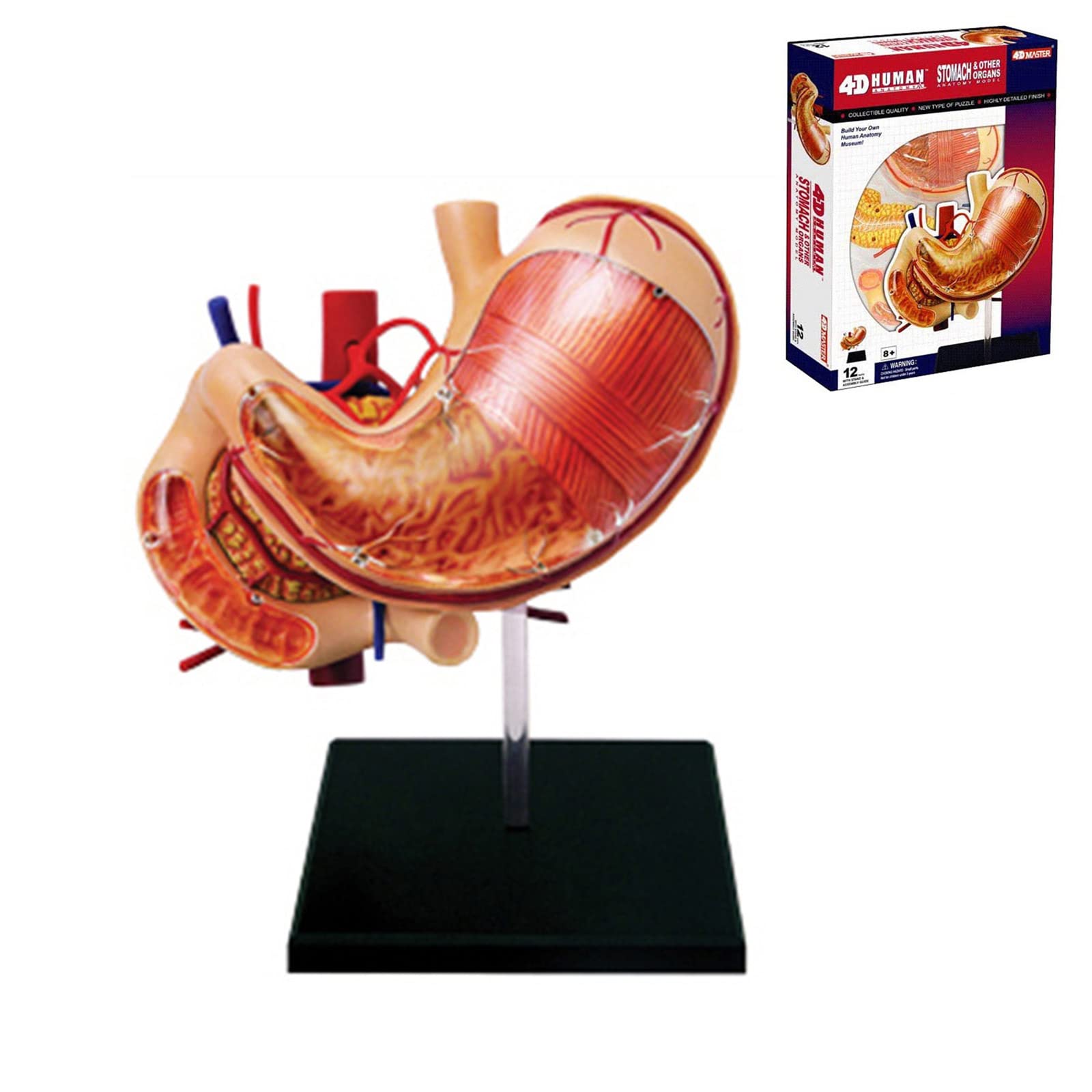 Human Stomach Gastroesophageal Reflux Disease Information | Mount